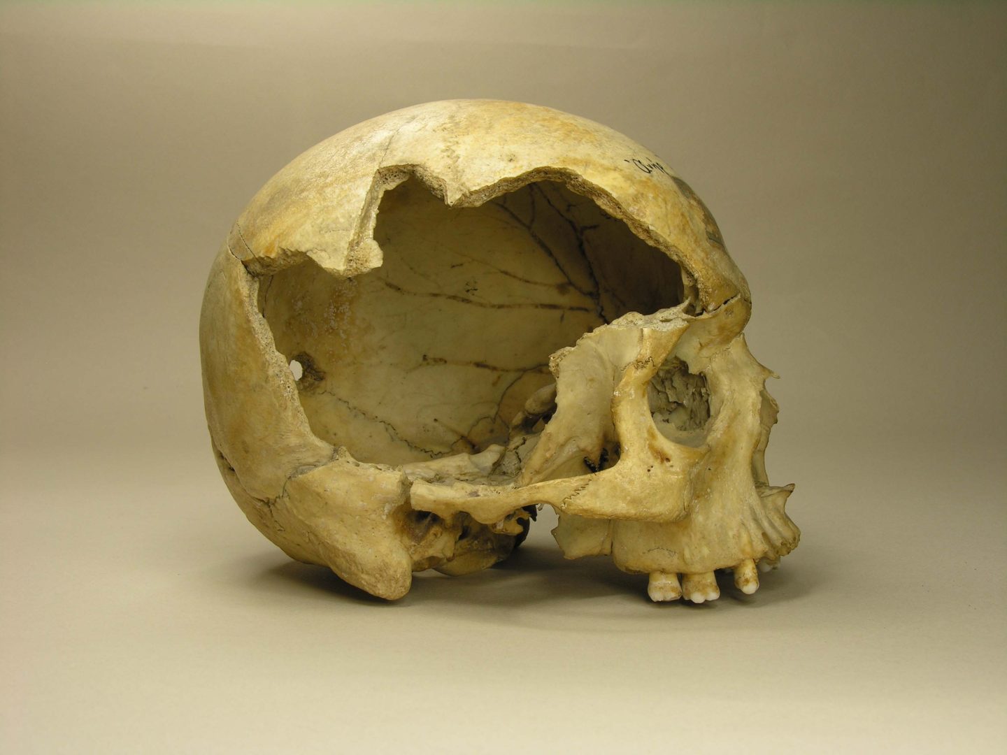 A Peak into the History of Gruesome Greek Crime | Athens Insider